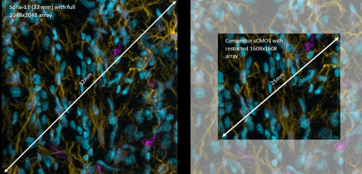 Sona-11 Series- Image Gallery – EINST Technology Pte Ltd.